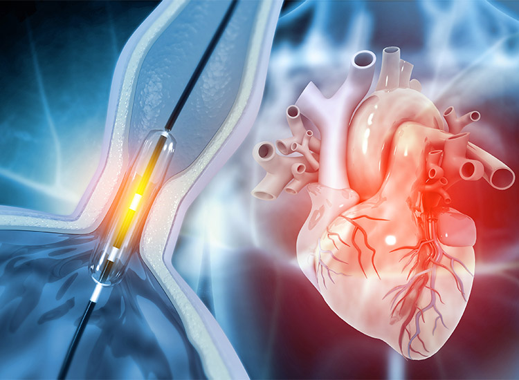 Managing And Healing Open Heart Surgery Scars A Comprehensive Guide
